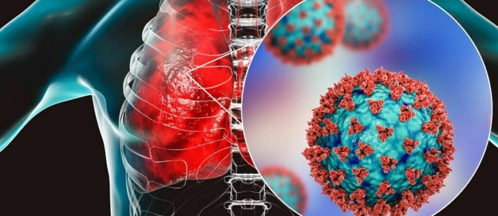 Comment la vitamine D pourrait réduire l'inflammation pulmonaire liée ... Comment la vitamine D pourrait réduire l'inflammation pulmonaire liée ...